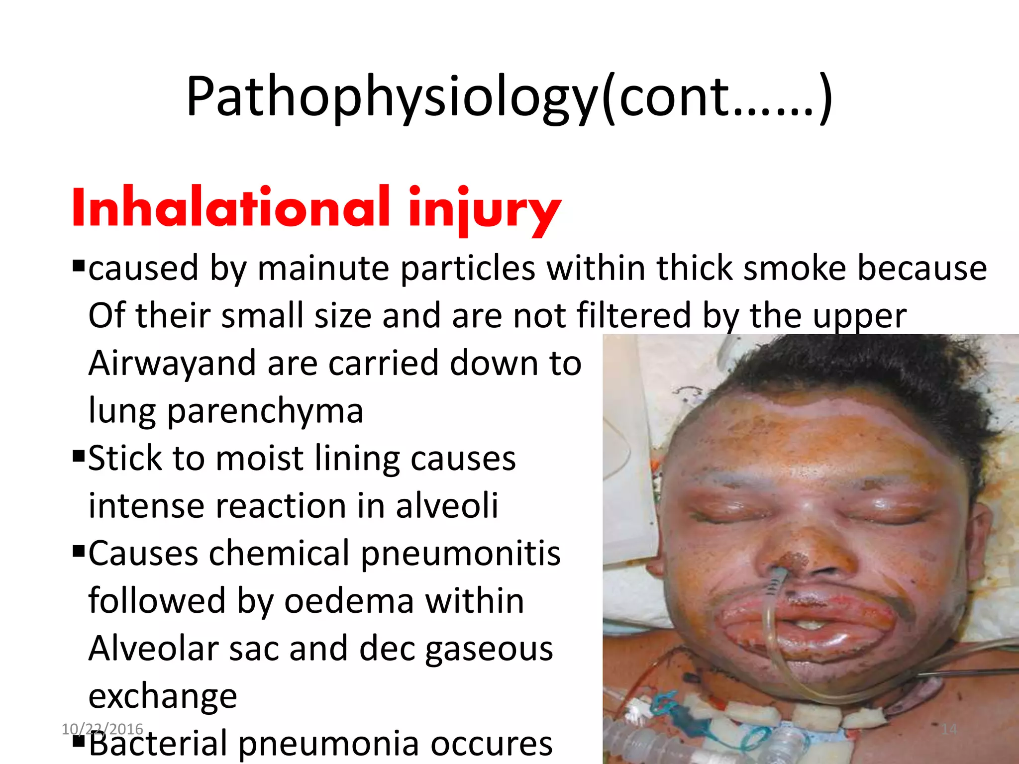 Burn classification and management | PPTX