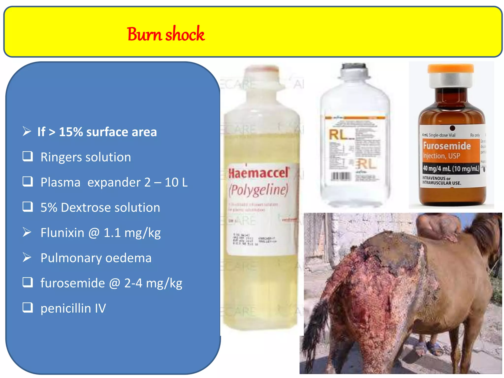 CRITICAL CARE AND MANAGEMENT OF BURN | PPTX