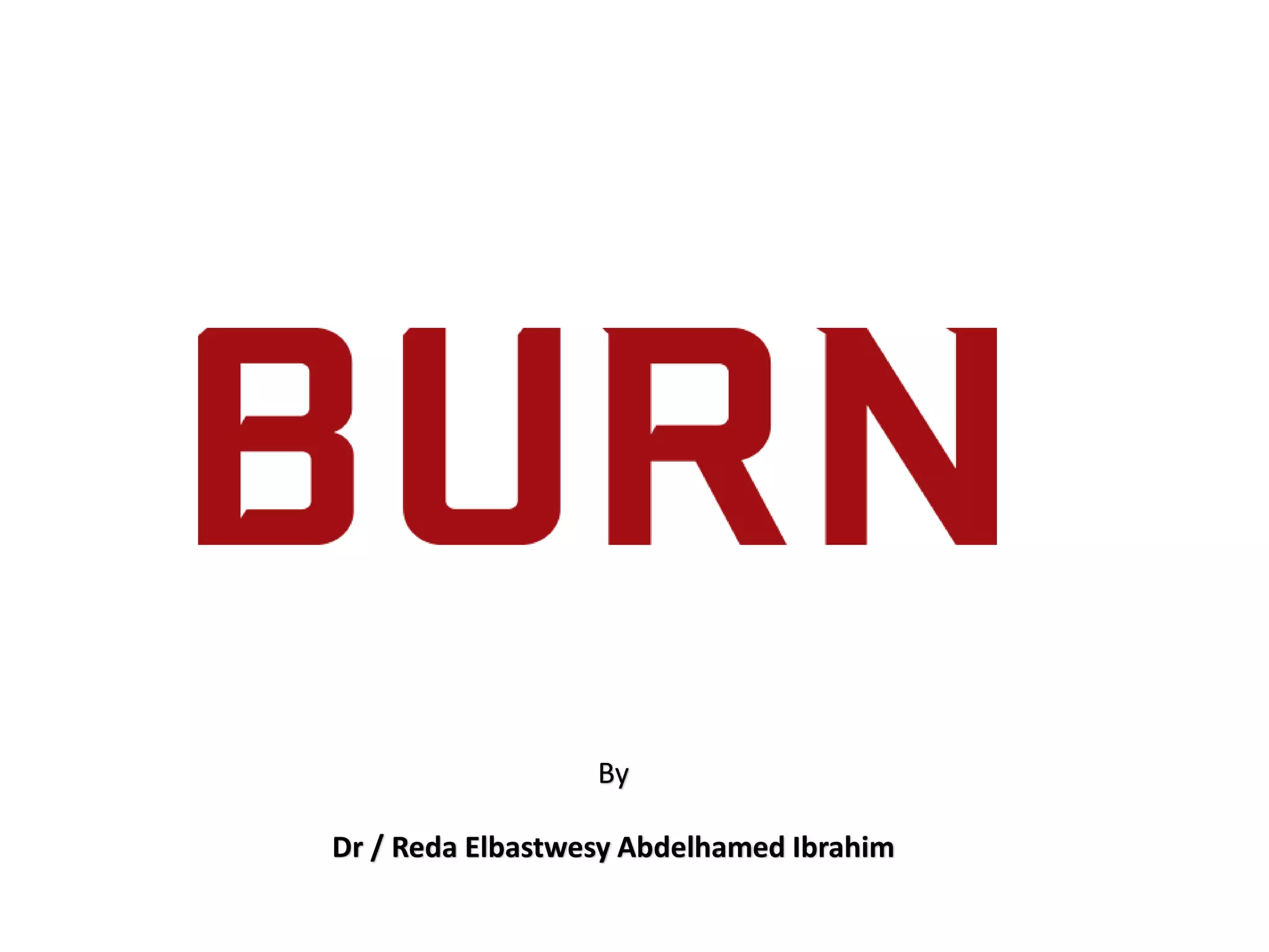Burn | PPTX