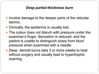 Burn | PPTX