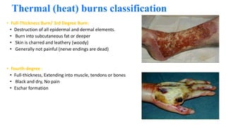 burn.pptx