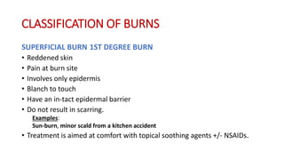 عرض تقديميburn.pptx