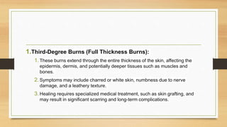 Burn & its Management for Nurses And Faculty of Nursing.pptx