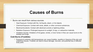 Burn & its Management for Nurses And Faculty of Nursing.pptx