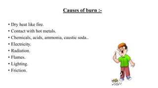 Understanding Burns: A Comprehensive Overview" | PPTX