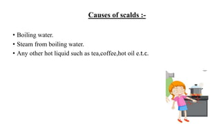 Understanding Burns: A Comprehensive Overview" | PPTX