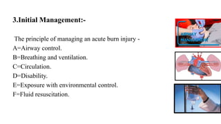 Understanding Burns: A Comprehensive Overview" | PPTX