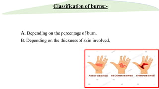 Understanding Burns: A Comprehensive Overview" | PPTX