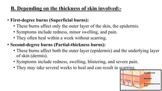 Understanding Burns: A Comprehensive Overview" | PPTX