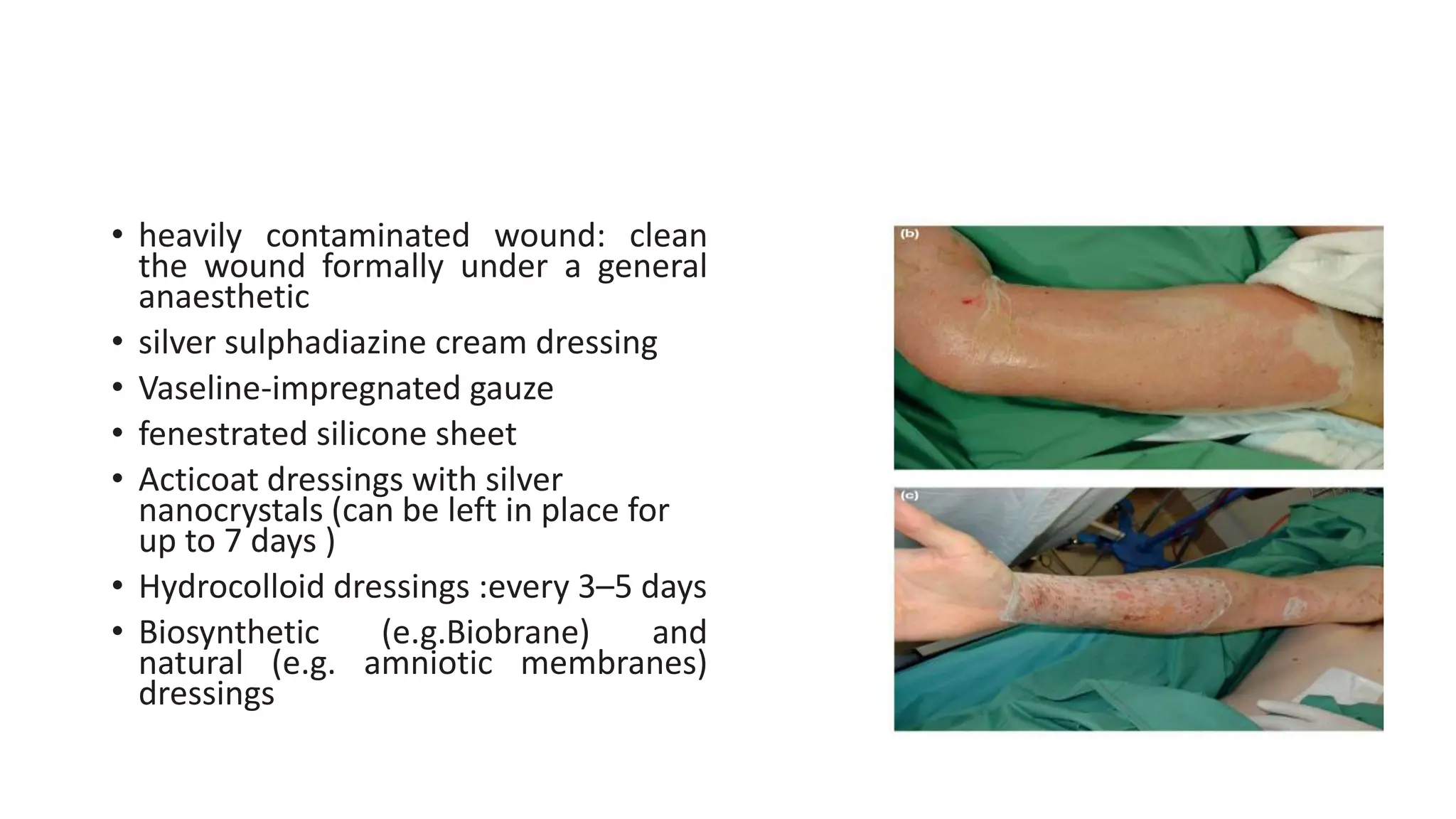 BURN. A brief note on burn and its management | PPT