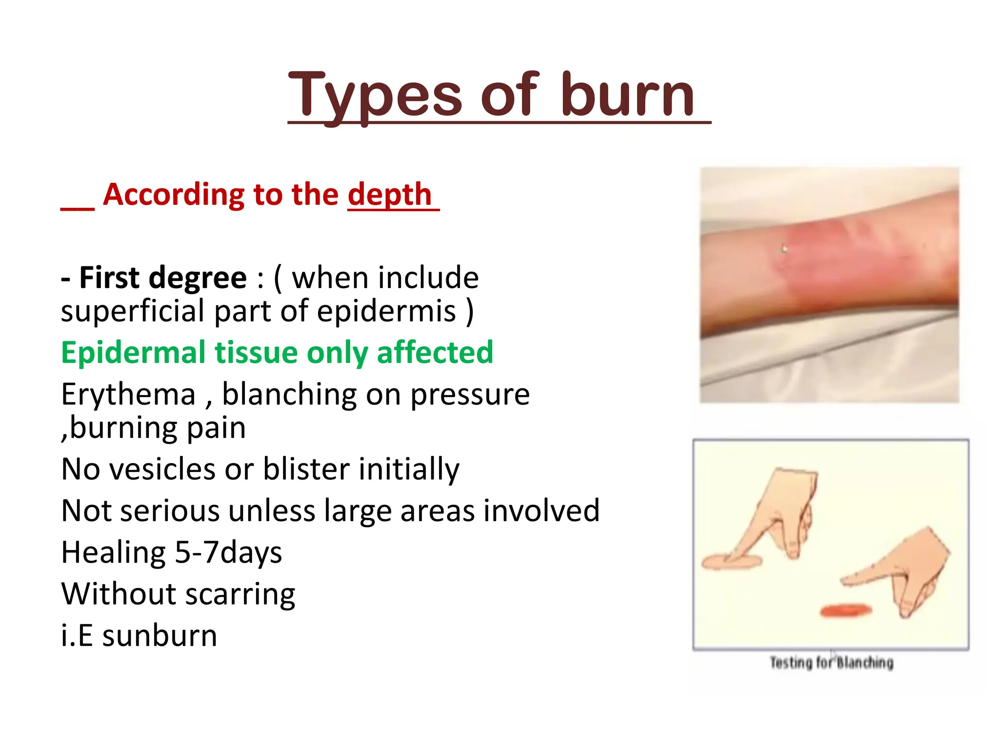 Burn.pdf for nursing student.ppt by raafat | PDF
