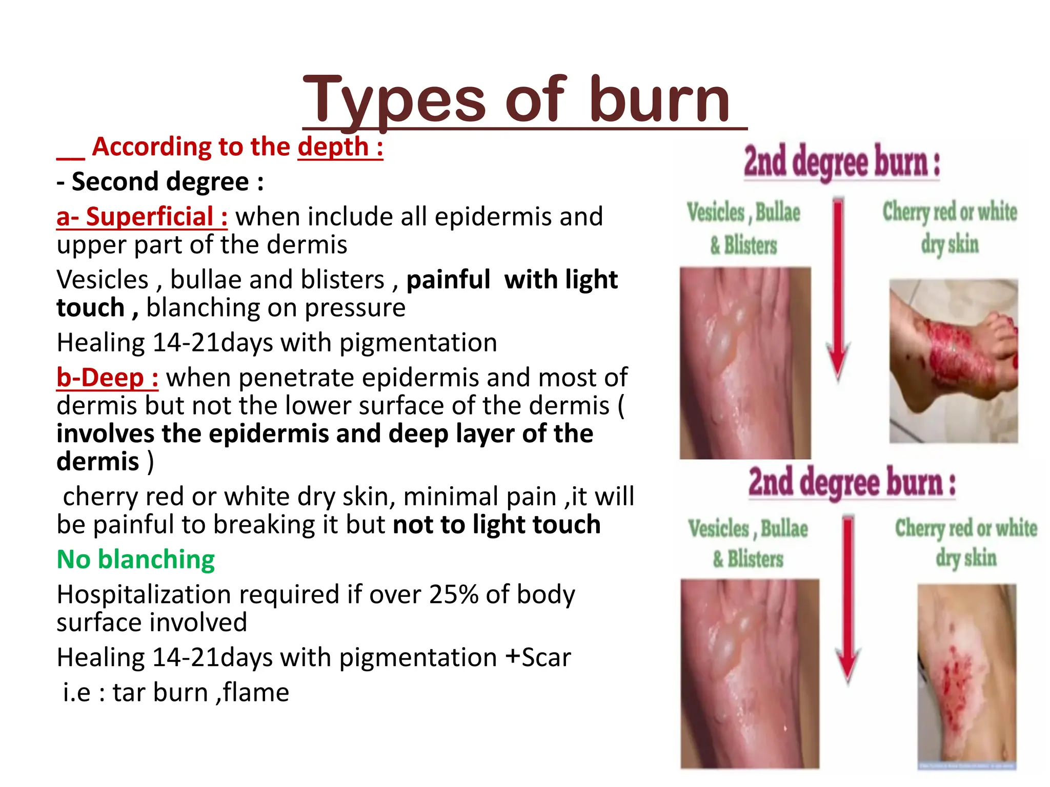 Burn.pdf for nursing student.ppt by raafat | PDF