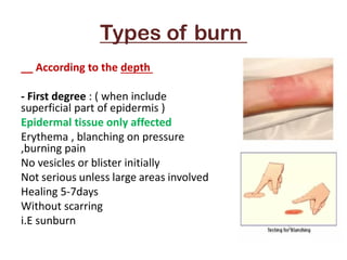 Burn.pdf for nursing student.ppt by raafat | PPT