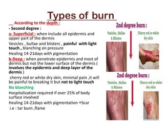 Burn.pdf for nursing student.ppt by raafat | PPT