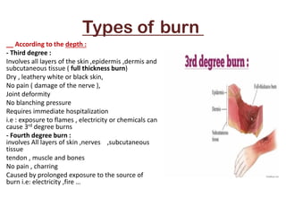 Burn.pdf for nursing student.ppt by raafat | PDF