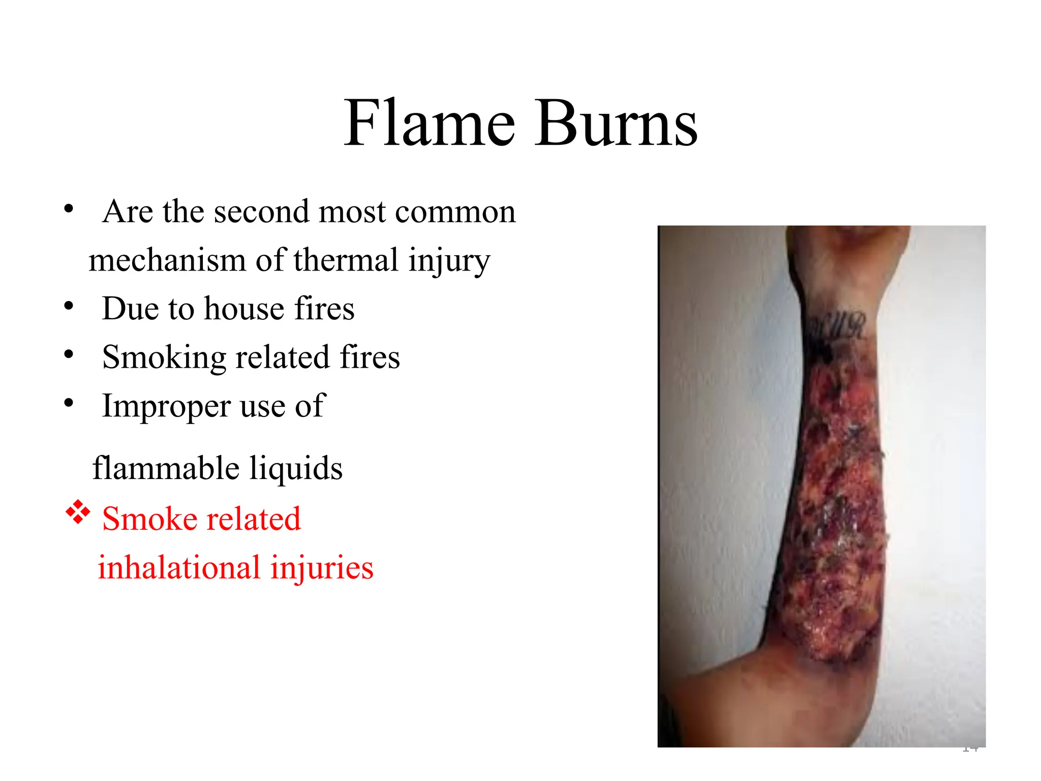 Burn.pptx fir medicine and public health | PPTX