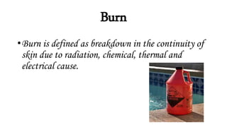 Burn first aid ppt | PPTX