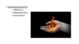 Burn first aid ppt | PPTX