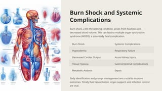 Nursing management of burn patient in emergency.pptx