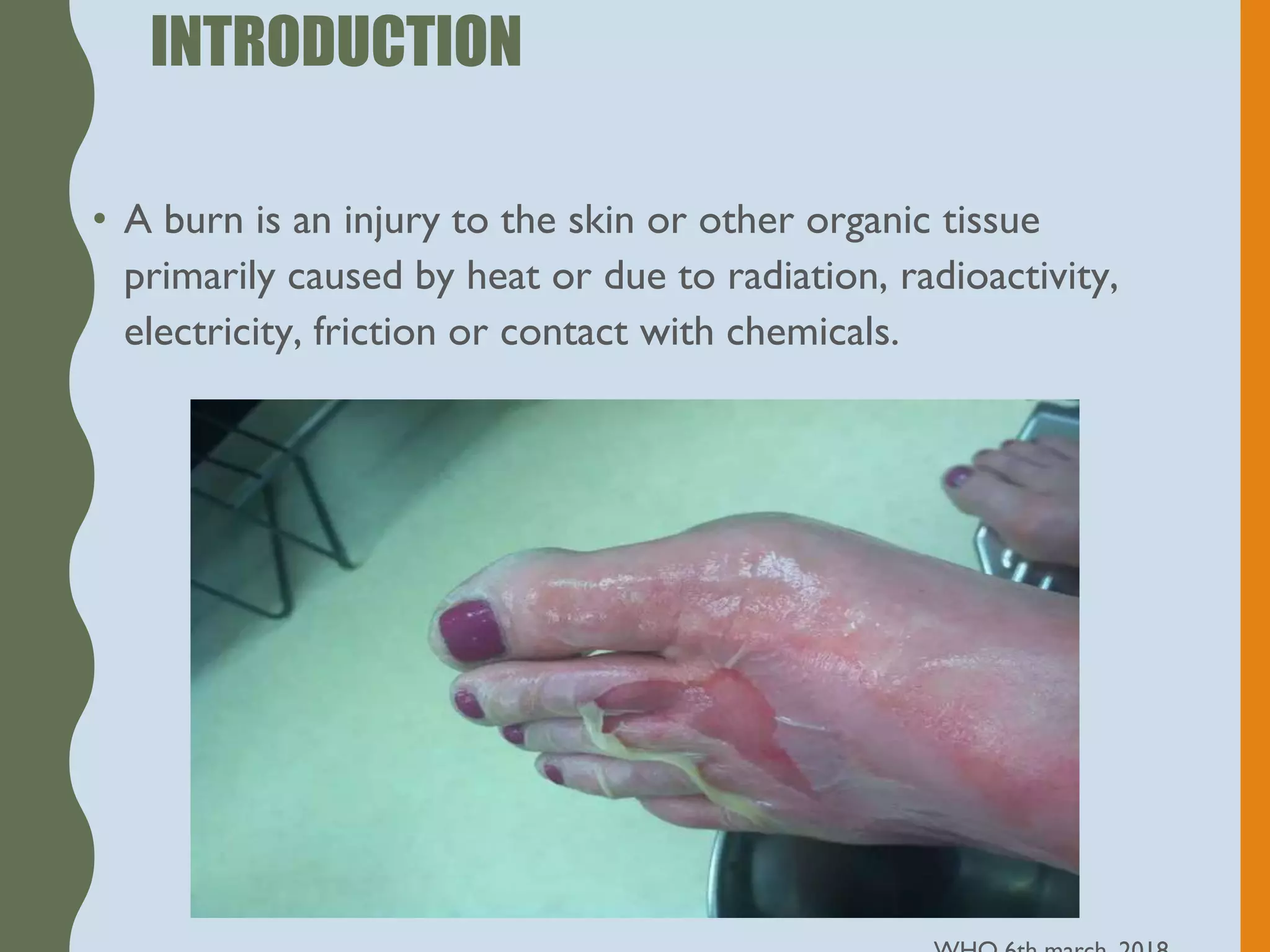 BURN (1).pptx
