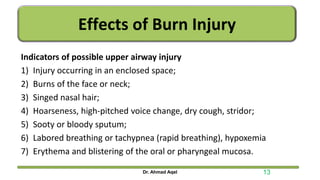 Burn 2021 | PPT