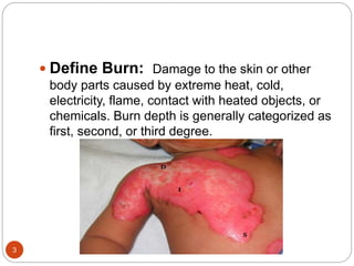 Burn (3 rd year) | PPTX
