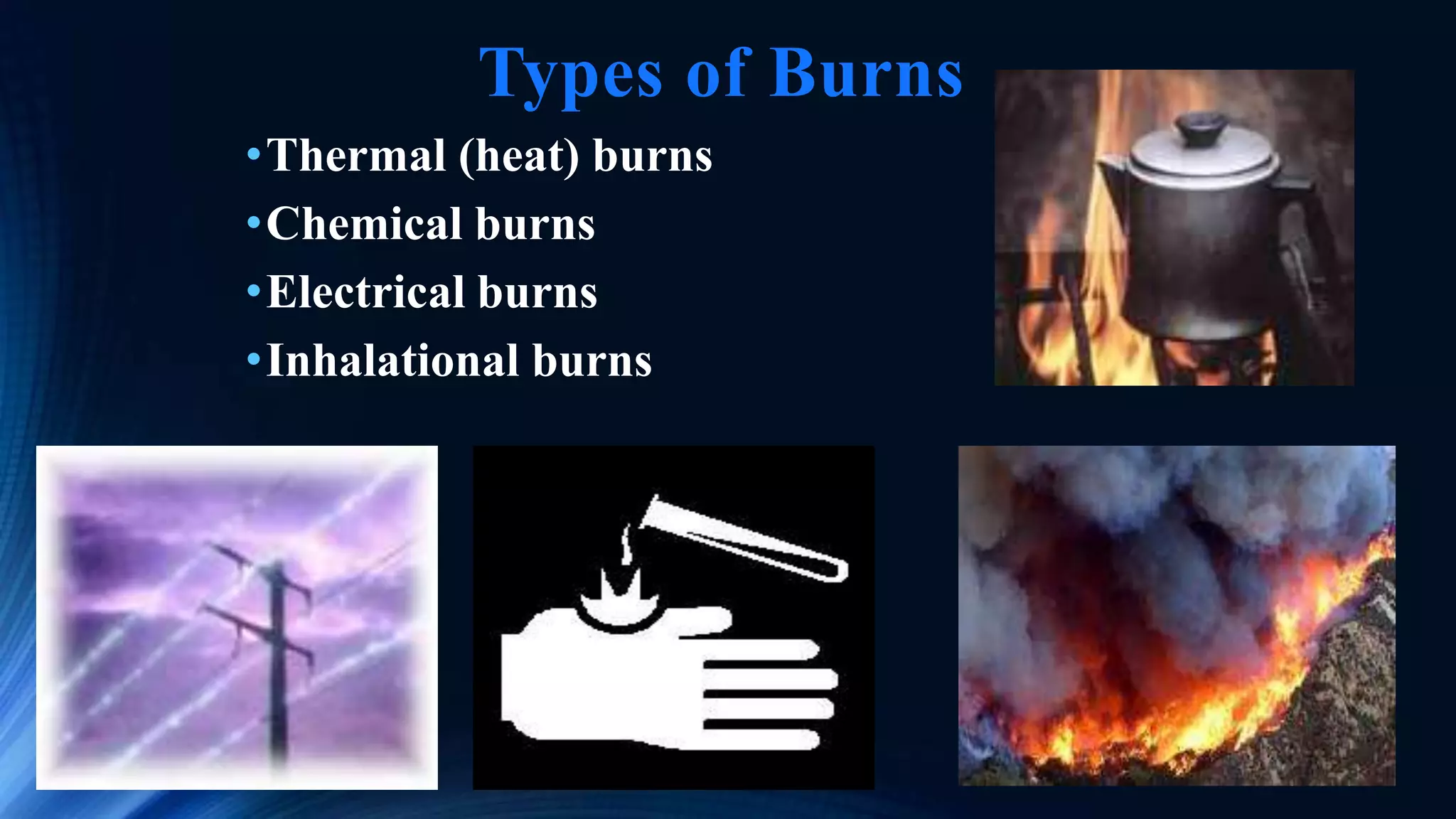 Burn and anaesthesia | PPTX