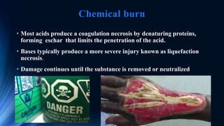 Burn and anaesthesia | PPTX