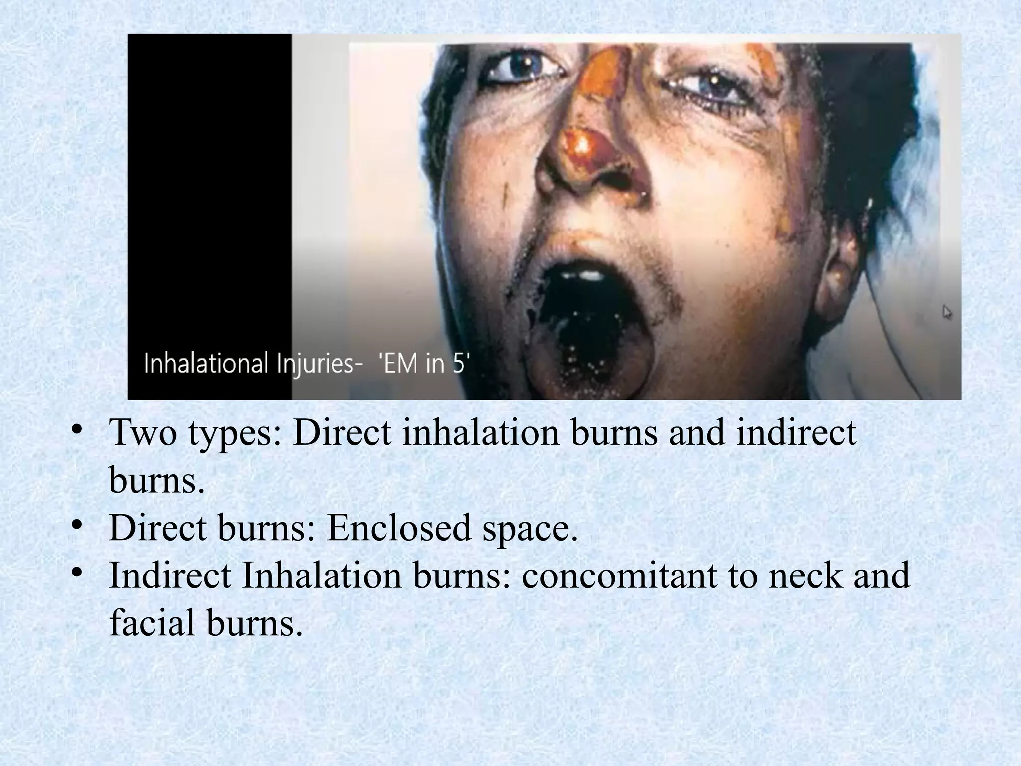 Burn and burn_rehabilitation | PDF