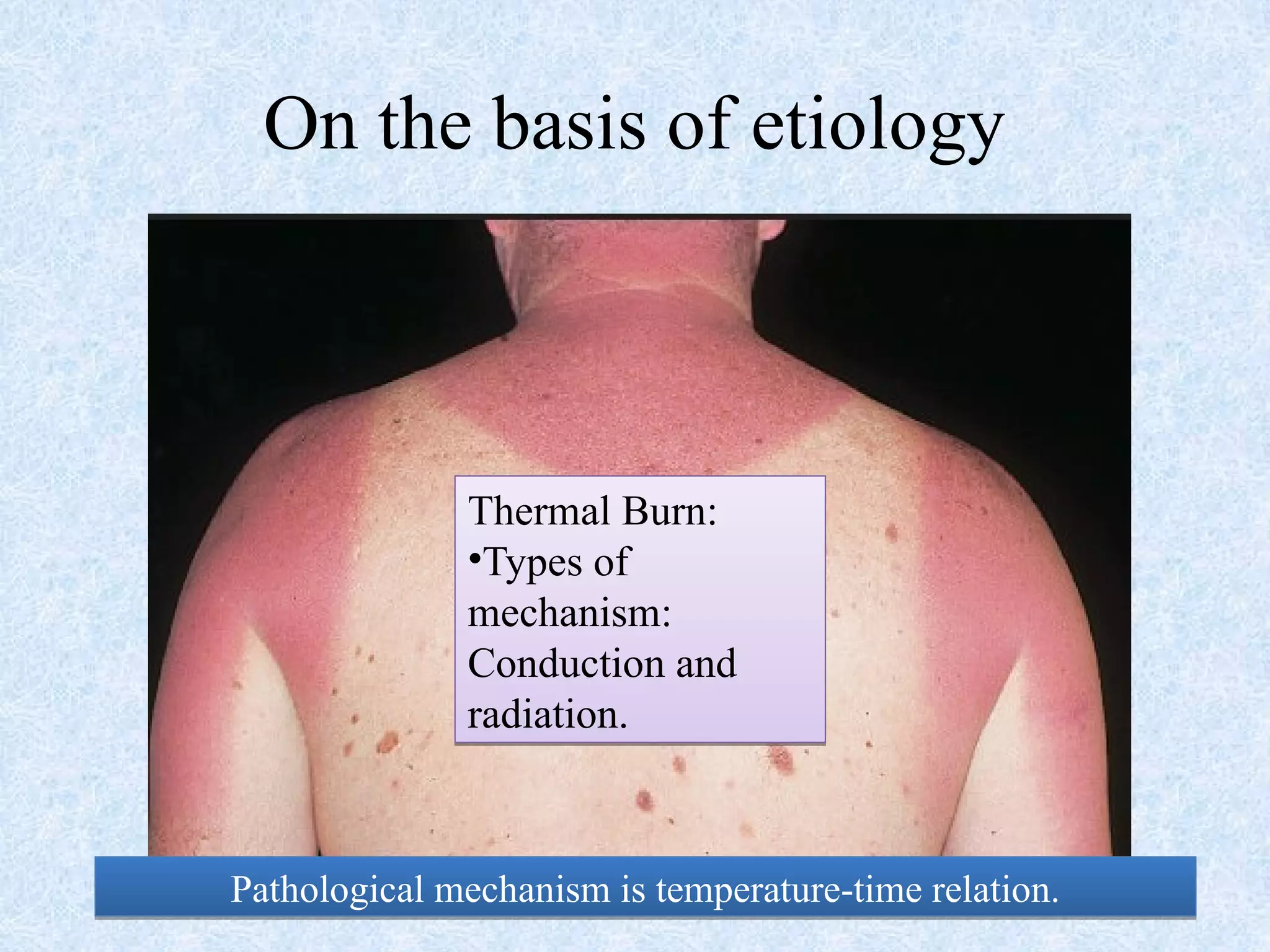 Burn and burn_rehabilitation | PDF