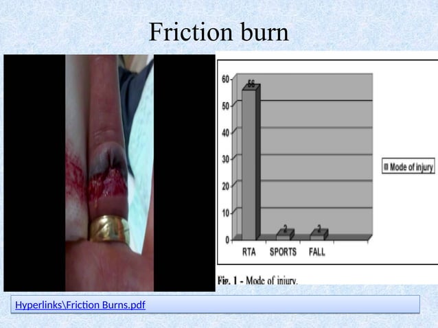 Burn and burn_rehabilitation | PDF | Injuries | Diseases and Conditions