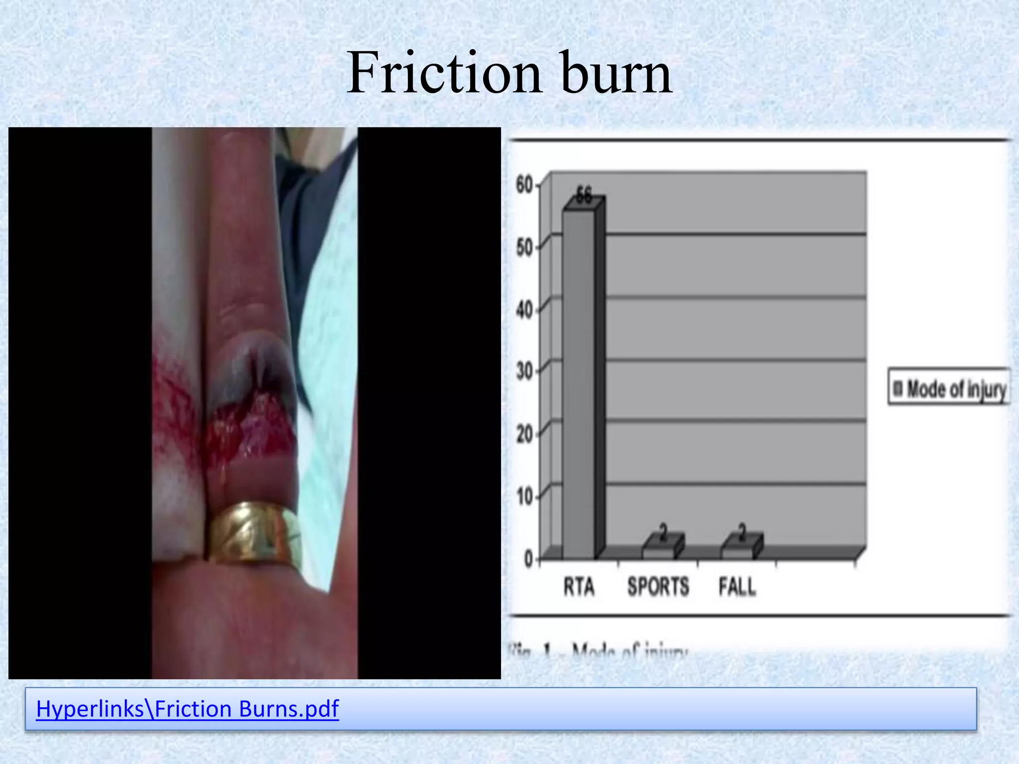 Burn and Burn Rehabilitation.pptx.ppt
