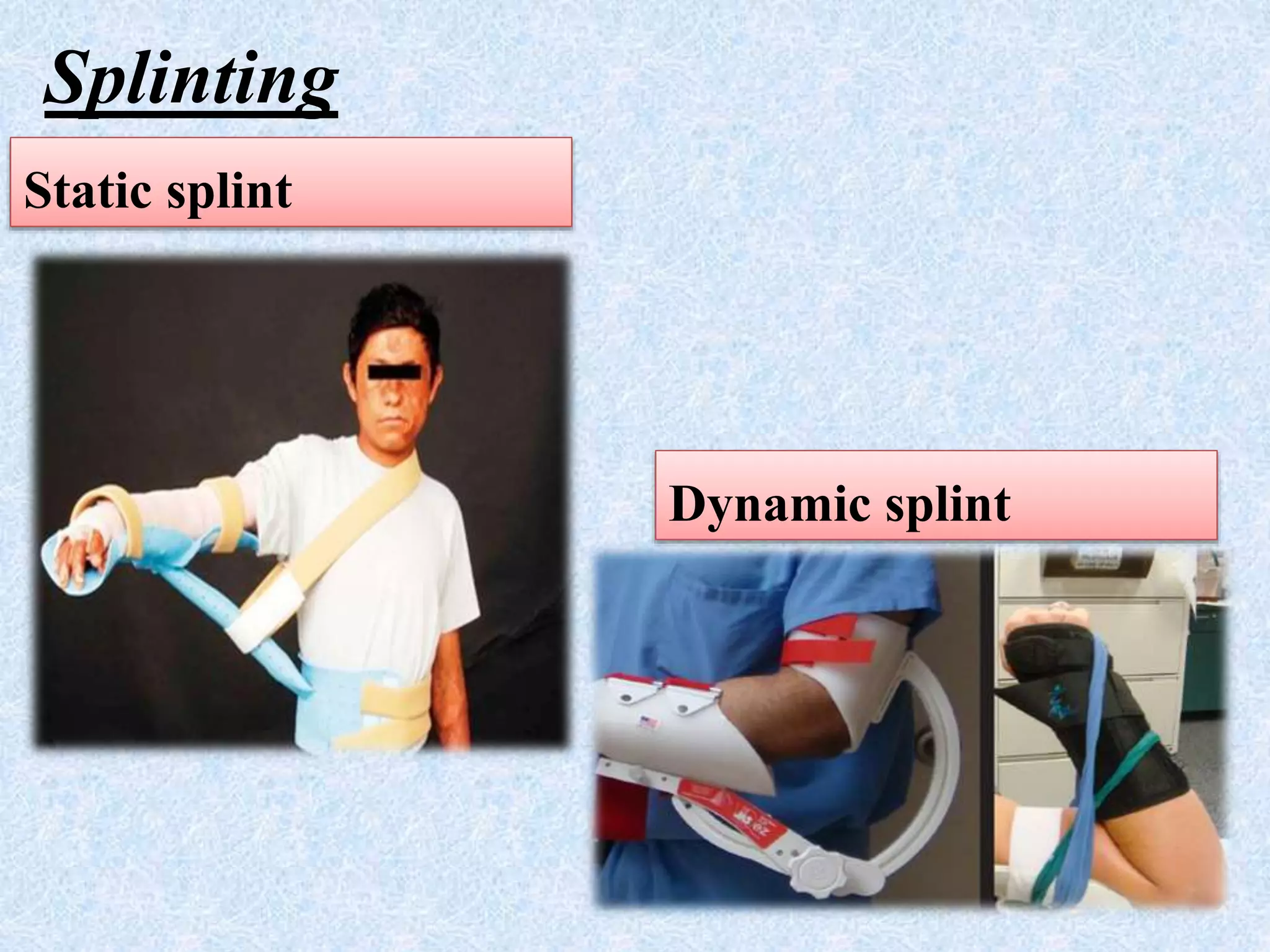 Burn and Burn Rehabilitation.pptx.ppt