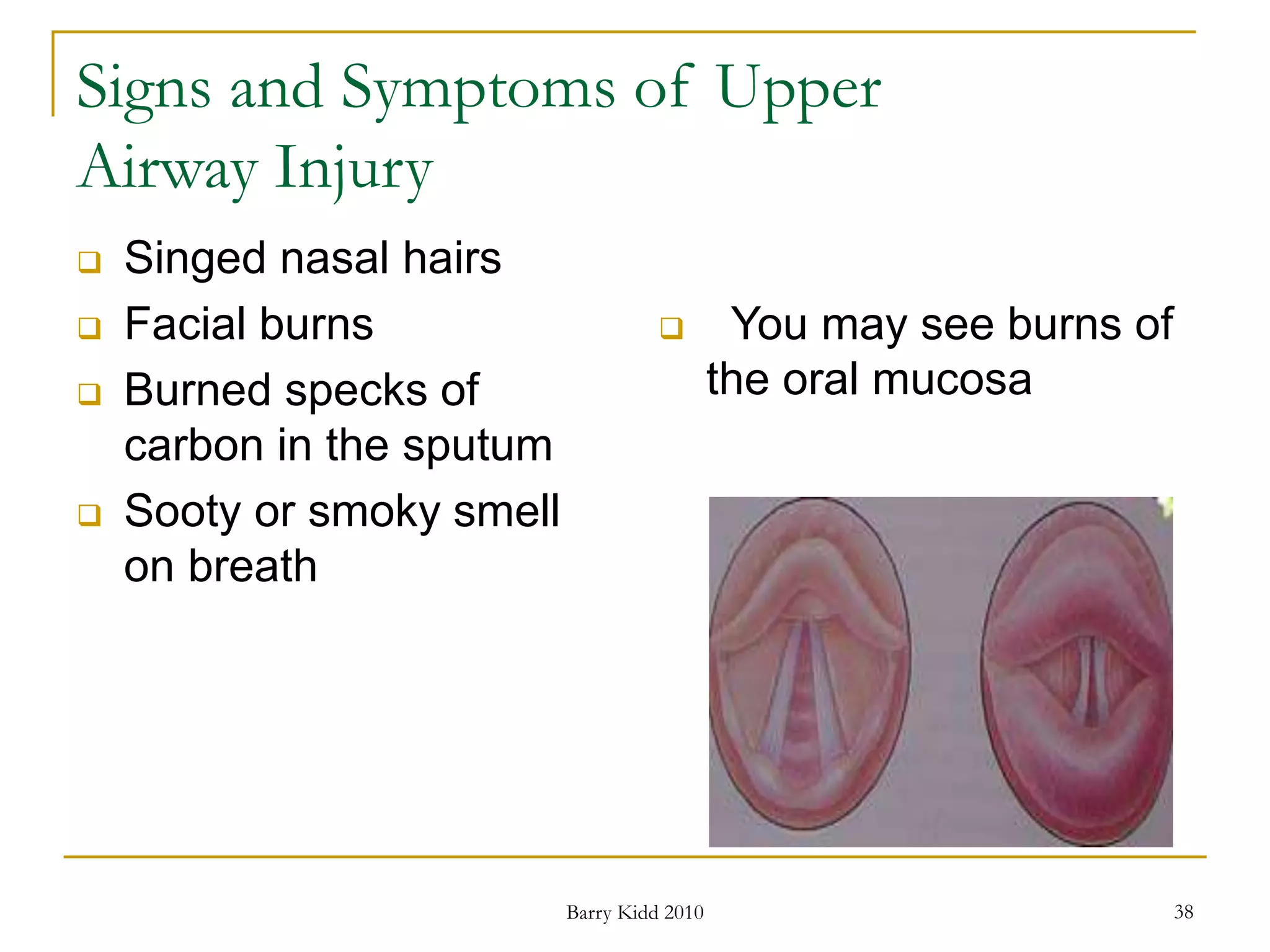 Burn assessment and management | PPT