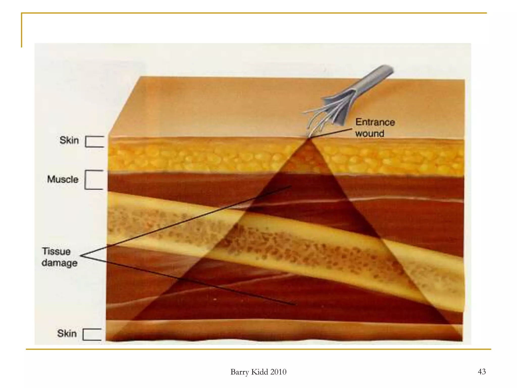 Burn assessment and management | PPT