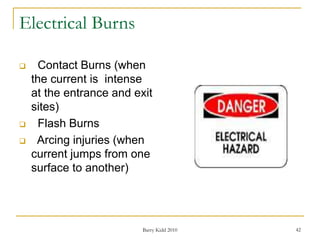 Burn assessment and management | PPT