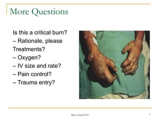 Burn assessment and management | PPT
