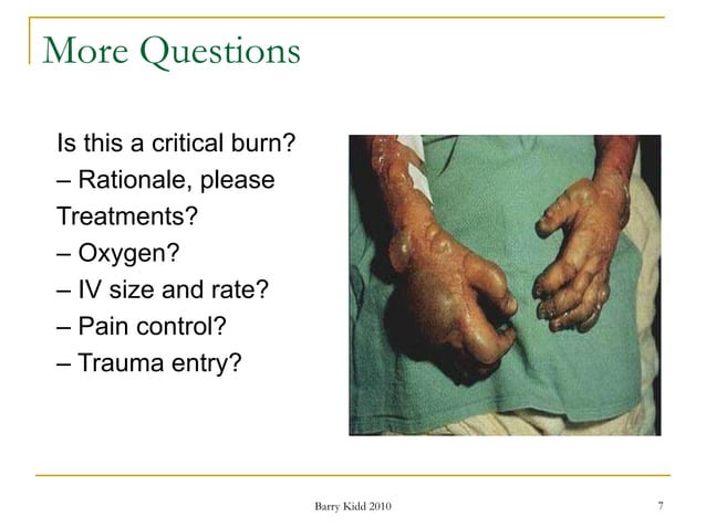 Burn assessment and management | PPT | First Aid | Injuries