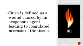 Burn | PPTX
