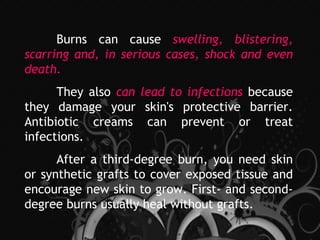 BurN baby Burn. | PPT