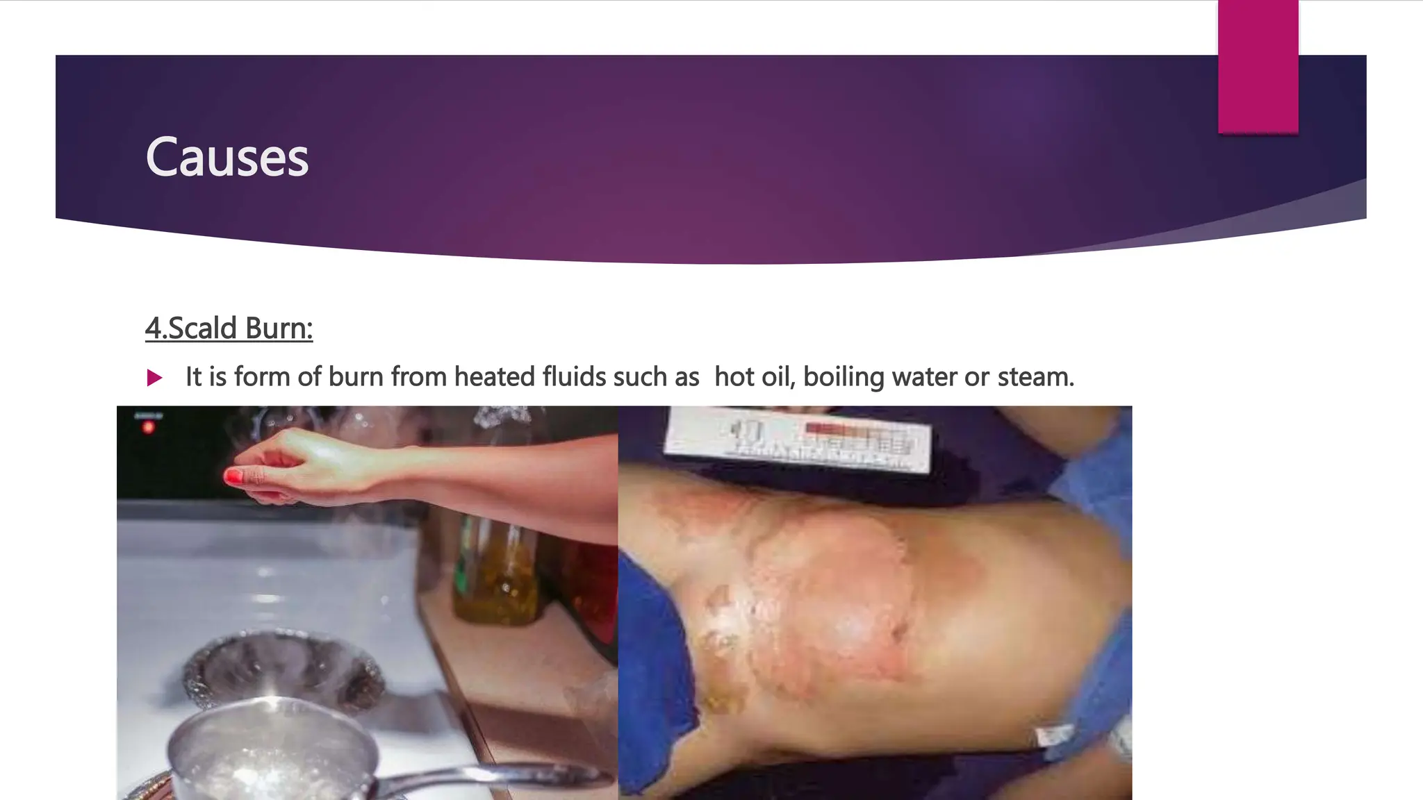 Burn child health Nursing 3rd year presentation..pptx