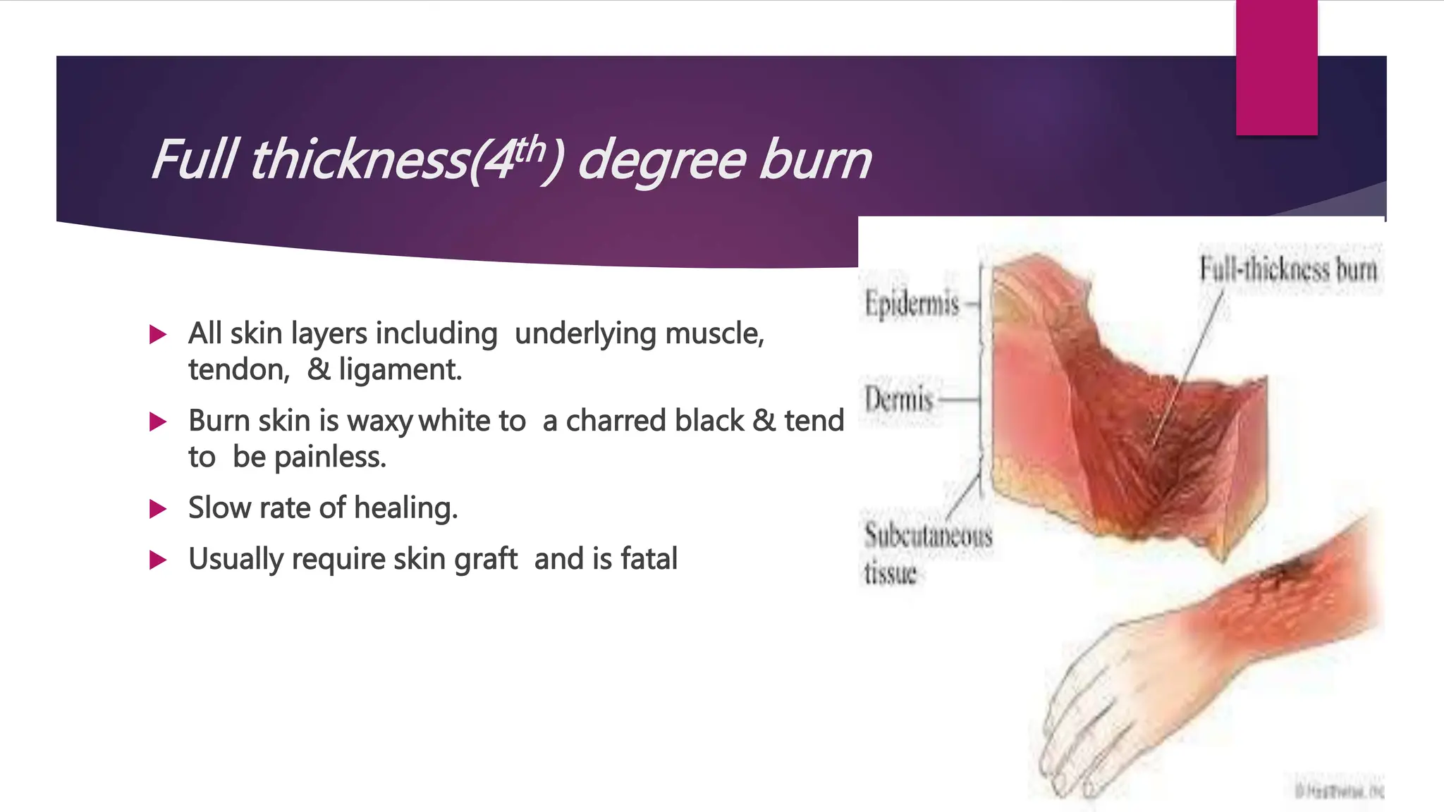 Burn child health Nursing 3rd year presentation..pptx
