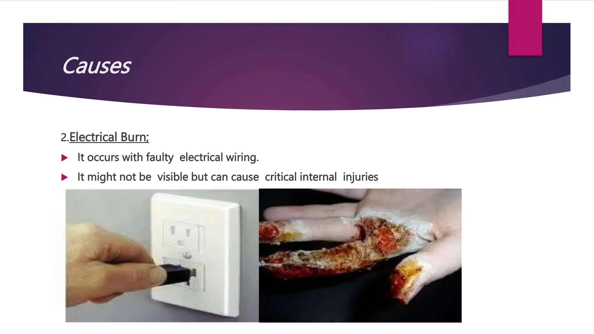 Burn child health Nursing 3rd year presentation..pptx