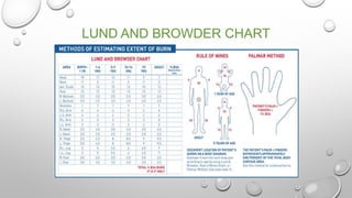 Introduction to burns and classification | PPTX