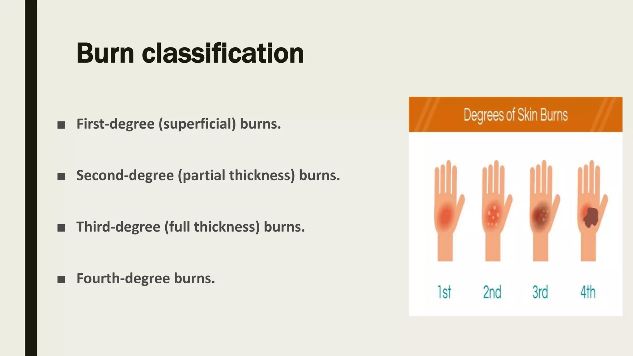 Burn classification | PPTX