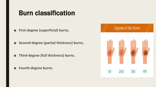 Burn classification | PPT
