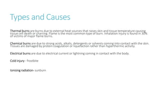 BURN CME.pptx