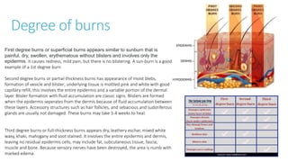 BURN CME.pptx