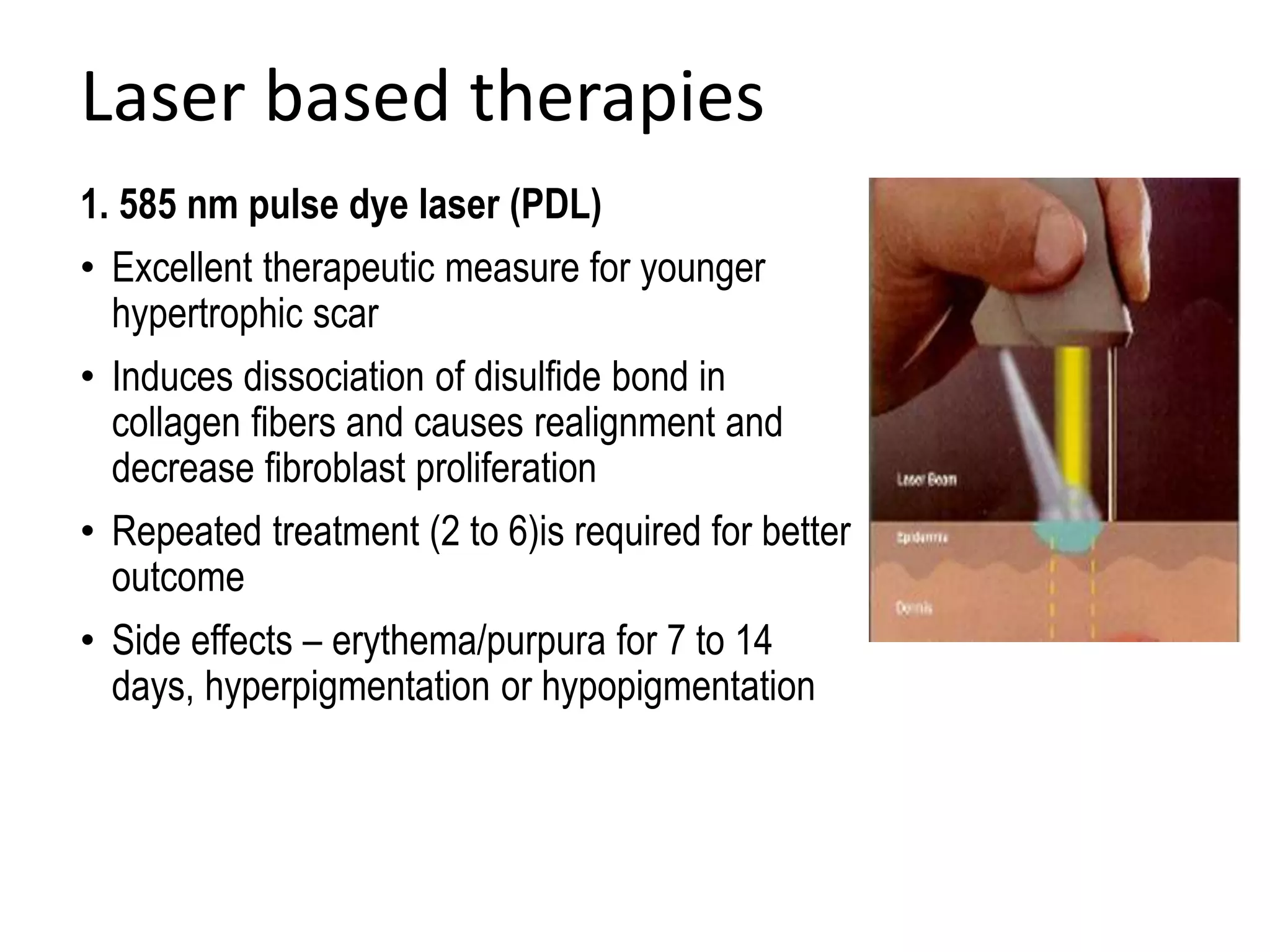 Burn complications and rehabilitation | PPTX