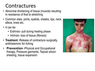 Burn complications and rehabilitation | PPTX
